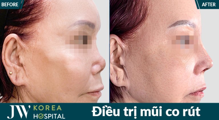 Bệnh viện JW định hướng tiên phong thẩm mỹ tái tạo và y học trường thọ